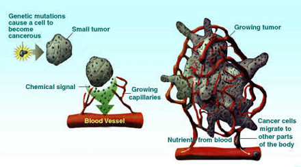 Beating Breast Cancer - Take2 Healthcare